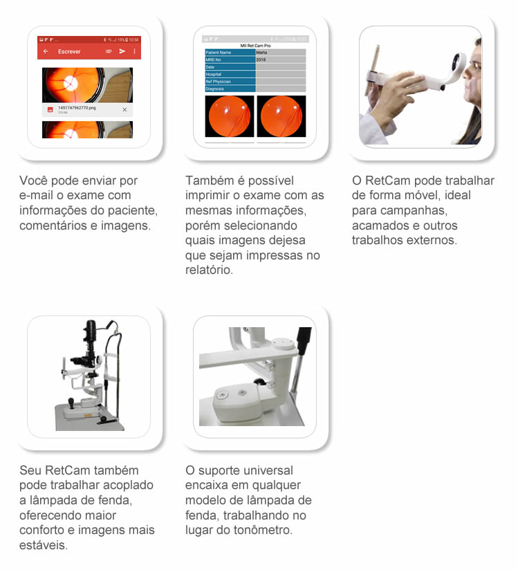 RetCam - Exames de fundo de olho de forma simples e fácil